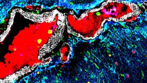 Geoffrey Jefferson Brain Research Centre | The University of Manchester