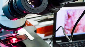 Geoffrey Jefferson Brain Research Centre | The University of Manchester