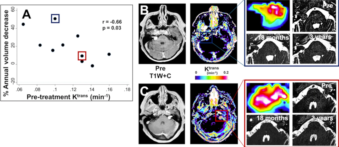 Geoffrey Jefferson Brain Research Centre | Translating imaging research ...